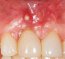 🦷 La cisti dentale: diverse tipologie e come curarla 🦷