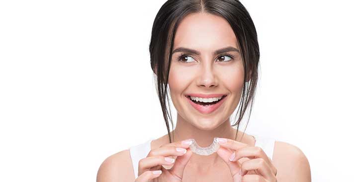 Invisalign Lite: ortodonzia per disallineamento dentale lieve