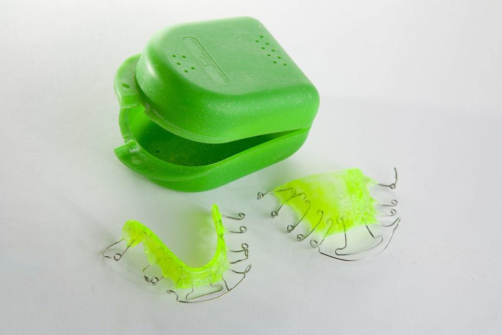 Apparecchio mobile: costo 💰, tipi e per chi è indicato