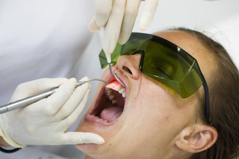 Cura laser per la parodontite: informazioni sul trattamento