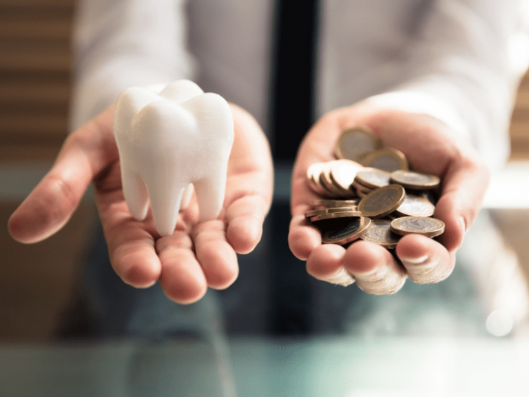 Ponte dentale: cos'è, quanto costa 💸 e come si installa;