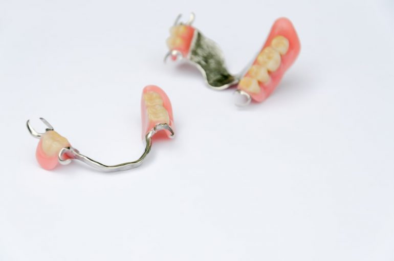 ️ Ponte dentale mobile: caratteristiche, costo e vantaggi ️