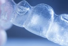 🔵 Attachment Invisalign, guida su attacchi o ganci Invisalign 🔵