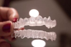 Spark o Invisalign: che marca di ortodonzia è migliore?