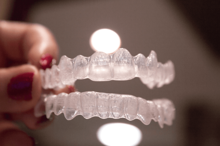 Invisalign vip 🌟: il segreto del sorriso delle celebrità