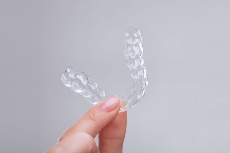 Bite dentale: cos'è, come si utilizza e quanto costa