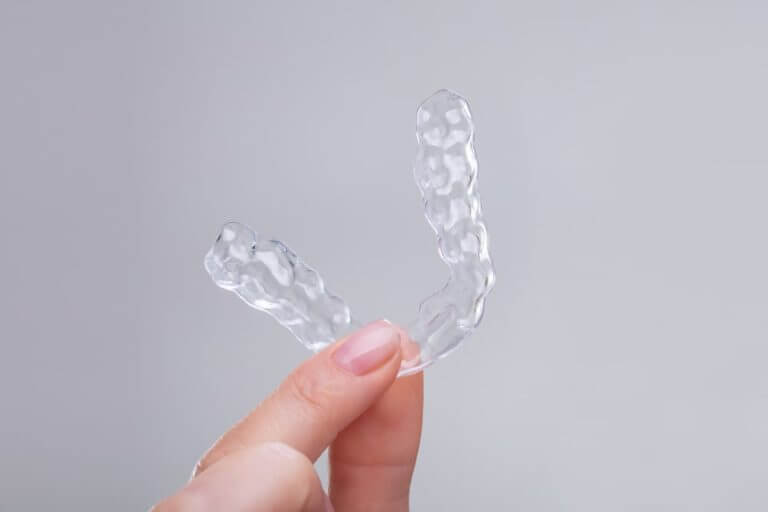 Bite rigido notturno: costo e vantaggi per il bruxismo