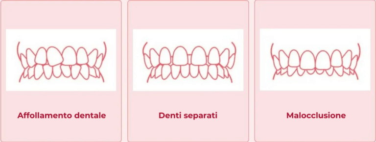 Impress: recensioni e costo di questa marca [Aggiornato 2024]